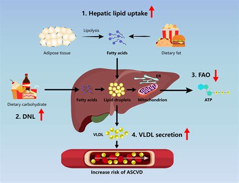 Impact Of NAFLD And Its Pharmacotherapy On Lipid Profile And CVD