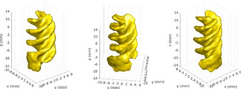 Figure 21 From Electron Paramagnetic Resonance Image Reconstruction With Total Variation