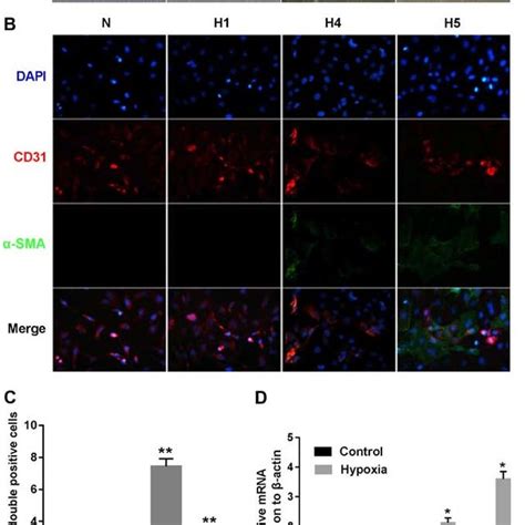 Hypoxia Induces Human Cardiac Microvascular Endothelial Cells Hcmecs