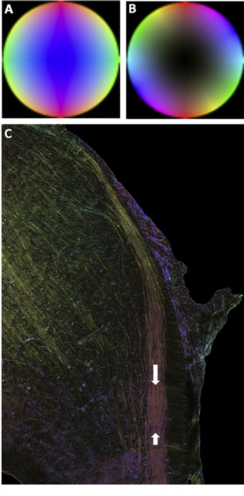 Figure 1 From The Hippocampus Of Birds In A View Of Evolutionary Connectomics Semantic Scholar