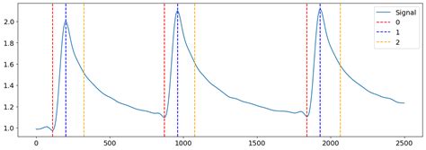 Analyze Electrodermal Activity Eda — Neurokit2 0212 Documentation