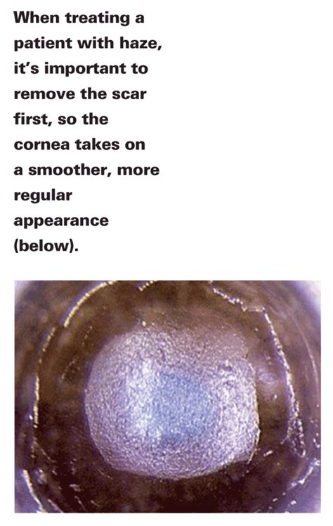 A Fresh Look At Mitomycin C