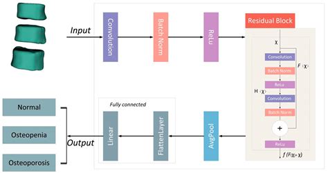 Automatic Osteoporosis Screening System Using Radiomics And Deep Learning From Low Dose Chest Ct