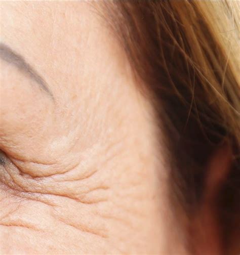 How To Remove Wrinkles In Photoshop Step By Step