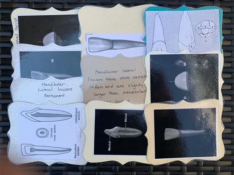 Dental Flashcards Incisor Tooth Morphology For Dental Hygiene Babes Etsy