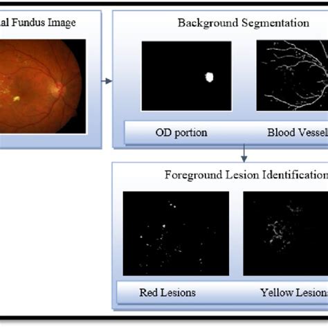 Visual Results For Background Segmentation Foreground Portion And Download Scientific Diagram