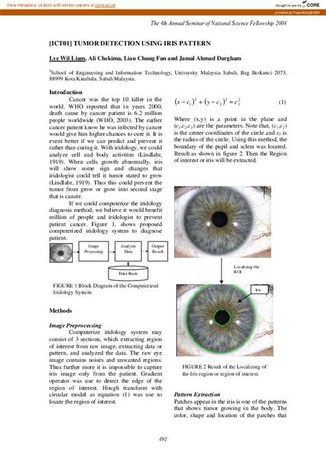 Pdf Tumor Detection Using Iris Pattern