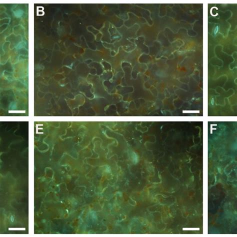Genetic Disruption Of Kei1 An Essential Component Of Ipc Synthase