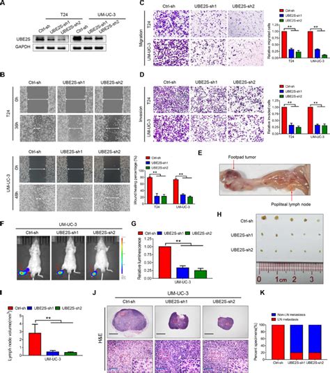 Ube2s Interacting With Trim21 Mediates The K11 Linked Ubiquitination Of Lpp To Promote The
