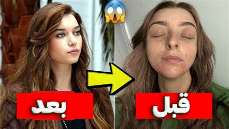 بازیگران ترکیه قبل و بعد از عمل زیبایی 😮 بازیگران ترکی که عمل زیبایی