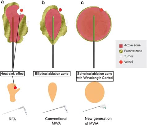 Thyroid Nodules Dr Konika