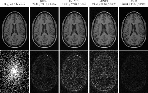 Deep Algorithm Unrolling For Biomedical Imaging