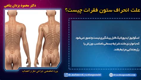 انحراف ستون فقرات یا اسکولیوز؛ دلایل و روش های درمان