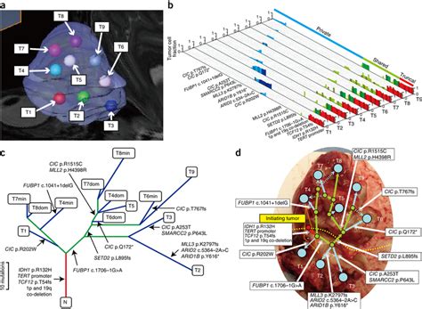 Intratumoral Heterogeneity And Clonal Evolution And Expansion In Grade