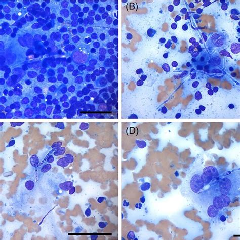 Cytology Of Peripheral Lymph Node A B And Spleen C D Ab Lymph