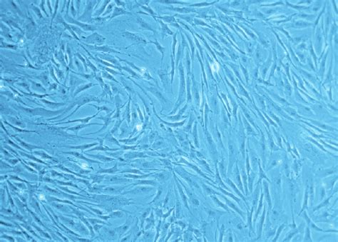 Human Aortic Adventitial Fibroblasts Haoaf Promocell Cells