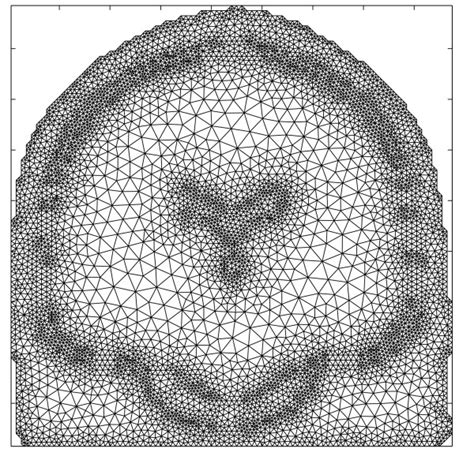 An Excitatory Post Synaptic Potential An Simplified Equivalent Circuit