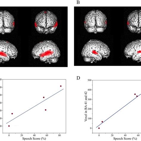 Correlation Between Speech Understanding And Extent Of Auditory Cortex Download Scientific