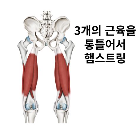 러닝에 의한 햄스트링 부상의 자가 진단 방법 치료 방법