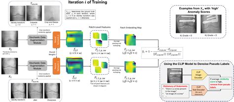Rethinking Knee Osteoarthritis Severity Grading A Few Shot Self Supervised Contrastive Learning