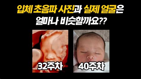 입체초음파 사진과 실물 얼굴과 비슷할까요 전격 비교 영상 Youtube