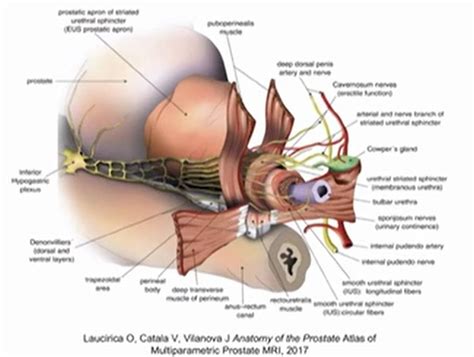 Suo 2021 Local Regional Anesthesia Considerations For Transperineal