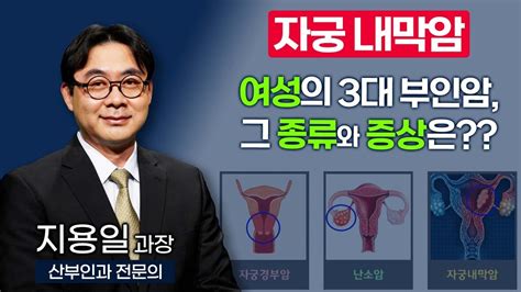 여성의 3대 부인암 자궁경부암 난소암 자궁내막암의 차이와 그 증상을 알려드립니다 Tv닥터인사이드 221212
