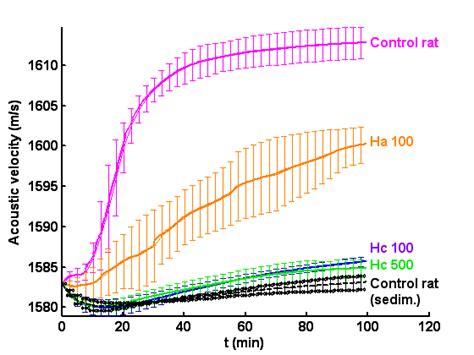Mean And Standard Deviation Values Of The Acoustic Velocity During The