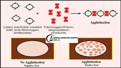 Fibrinogen Degradation Products Test Principle Procedure