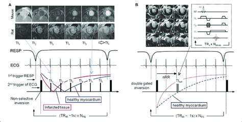 Pulse Sequence Diagrams For Lge Imaging A Look Locker Pulse Download Scientific Diagram