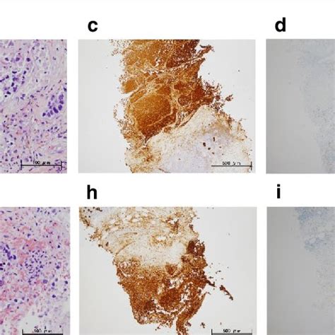 Postoperative Histopathological Findings Histopathological Findings Of