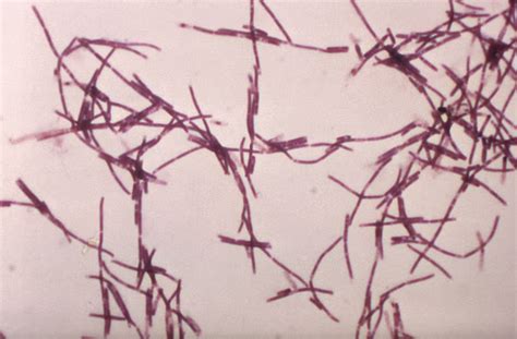 ancient pathogens released from melting ice could wreak havoc on the