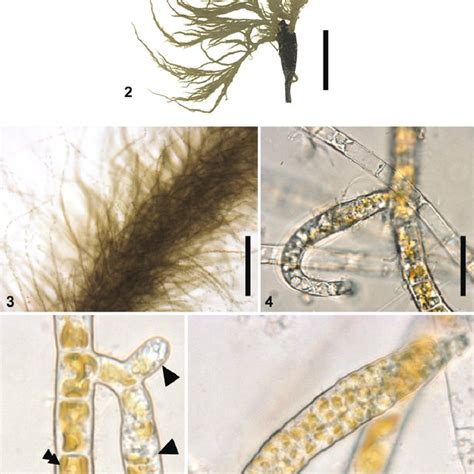 Pdf Systematics And Evolutionary History Of Pyrenoid Bearing Taxa In