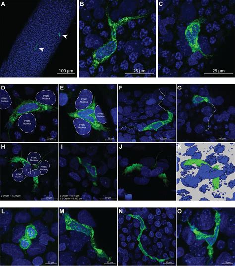 A Major Histocompatibility Complex Class Ii Mhcii þ Peritubular A Major Histocompatibility Complex Class Ii Mhcii þ Peritubular