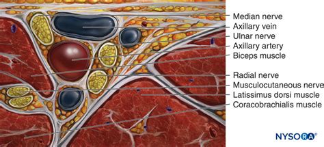 Axillary Brachial Plexus Block Landmarks And Nerve Stimulator Technique NYSORA