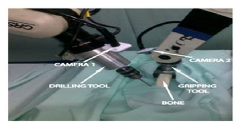 The 6 DOF Robot Manipulator Is Involved In The Drilling Of The Bone And Download Scientific