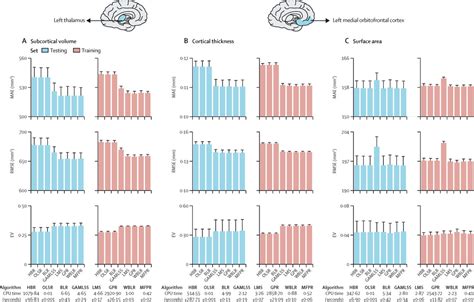 Normative Modelling Of Brain Morphometry Across The Lifespan With