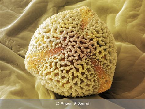 Spores Seeds And Pollen Ps Micrographs