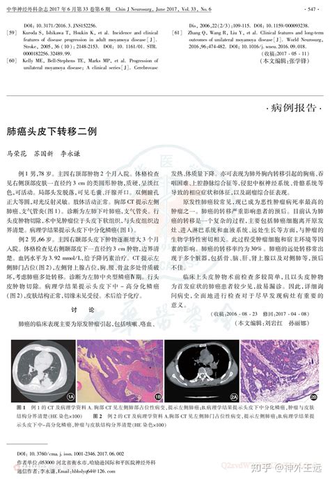 烟雾病和烟雾综合征诊断与治疗中国专家共识 2017 知乎