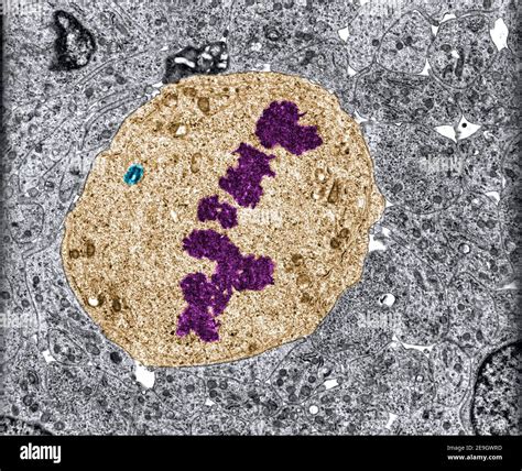 False Colour Transmission Electron Microscope Tem Micrograph Mitotic