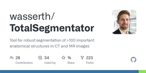Problem Running Totalsegmentator In Slicer 54 Support 3d Slicer Community
