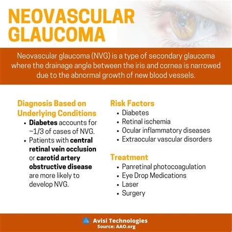 Neovascular Glaucoma