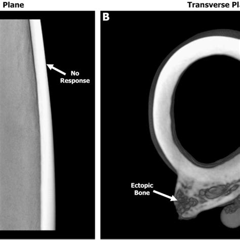 Representative Three Dimensional Reconstructed Micro Ct Scans From A