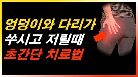 이상근 증후군 치료법 이 영상 하나로 끝 엉덩이통증 다리저림 Youtube