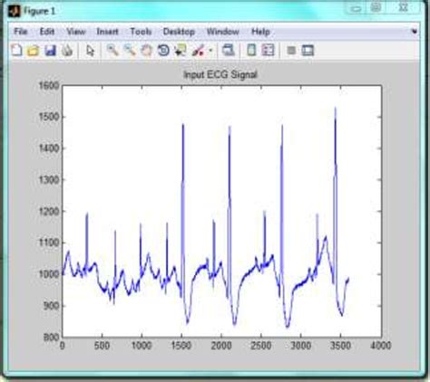 Figure 3 5 From Detection Of Abnormal Ecg Signal Using Dwt Feature Extraction And Cnn Semantic