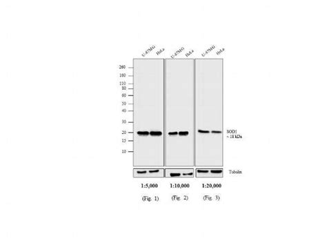 Invitrogen Rabbit Anti Mouse Igg Hl Secondary Antibody Ap 1 Ml