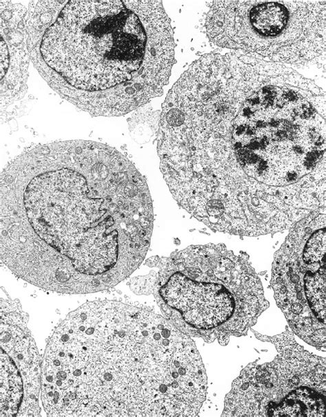 Electron Microscopy Of U937 Cells Undergoing Replication 24 Hr After