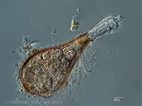 Bdelloid Rotifers By Aydin Örstan And Michael Plewka Quekett