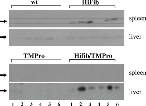 Figure 2 From Cause Effect Relation Between Hyperfibrinogenemia And Vascular Disease Semantic