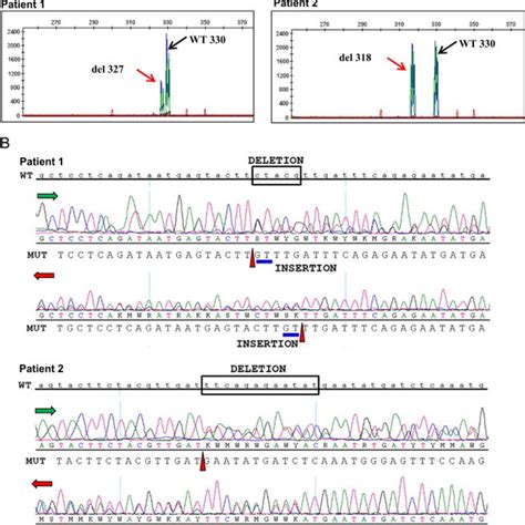 Flt3 Mutant Allele Expression Rt Pcr Across The Flt3 Juxtamembrane Download Scientific Diagram